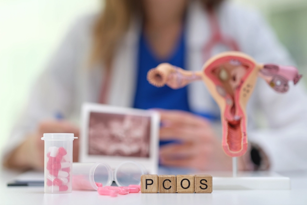 PCOS: Meaning, Causes, Symptoms, and Treatment Options You Should Know